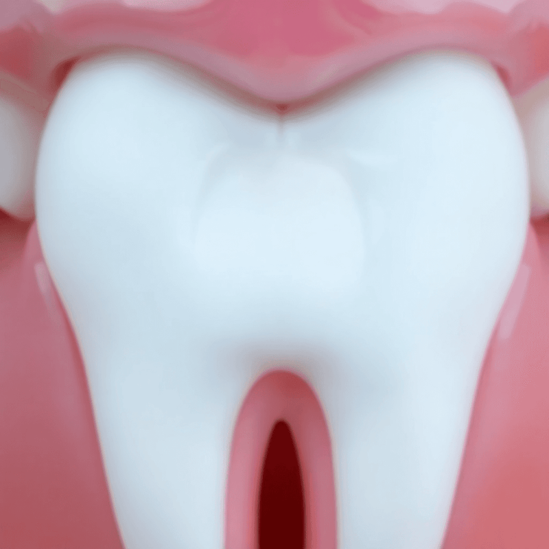 Hydroxyapatite And Cpp Acp For Tooth Remineralization