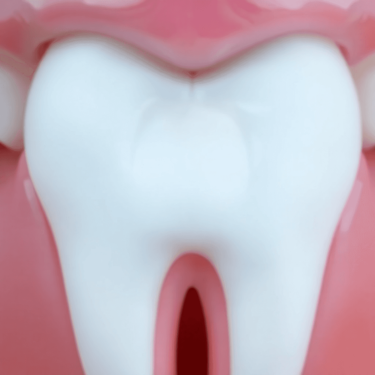 Hydroxyapatite And Cpp Acp For Tooth Remineralization A Natural